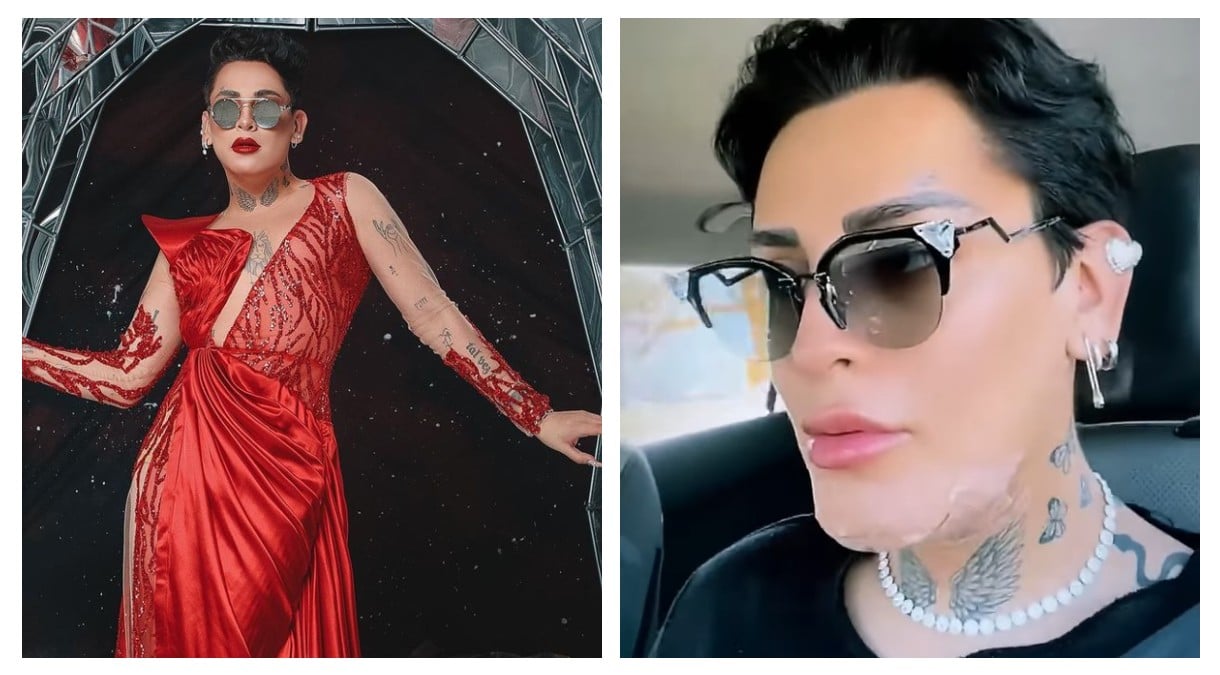 Kunno se queda sin poder sonreír tras realizarse una cirugía estética ...