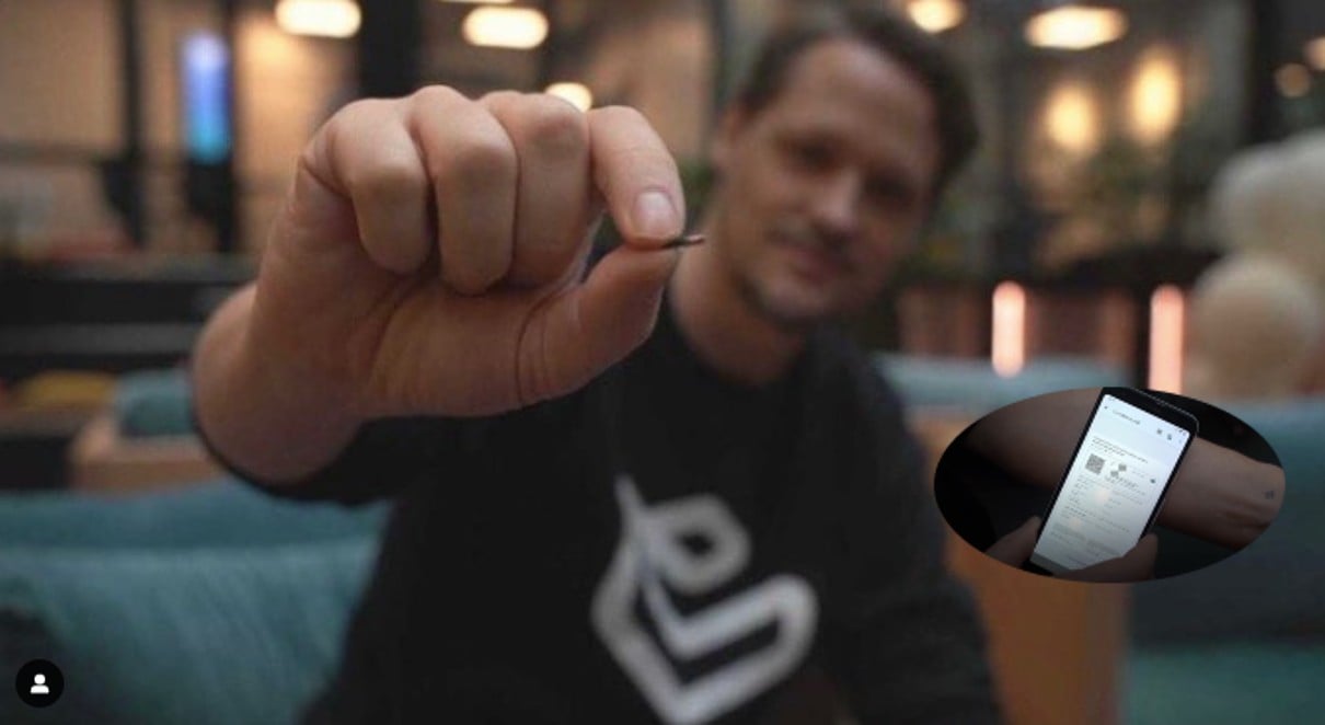 Así funciona el chip debajo de la piel que permite guardar el ...