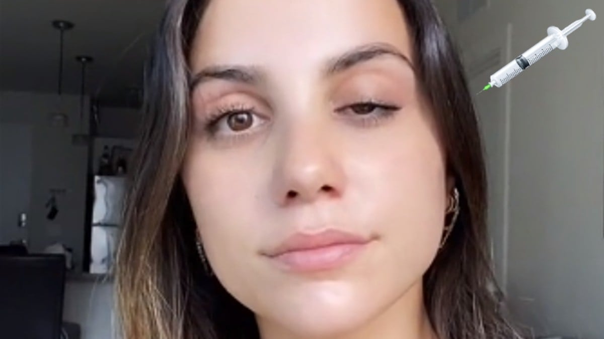Joven Se Somete A Tratamiento De Botox Y Termina Con El Párpado Caído
