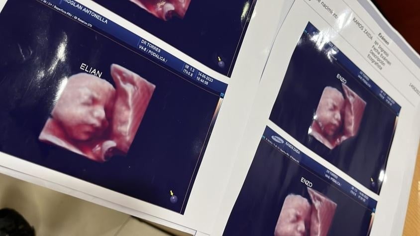 Clínica entregaba la misma ecografía 5D a todas las pacientes | Quinto ...