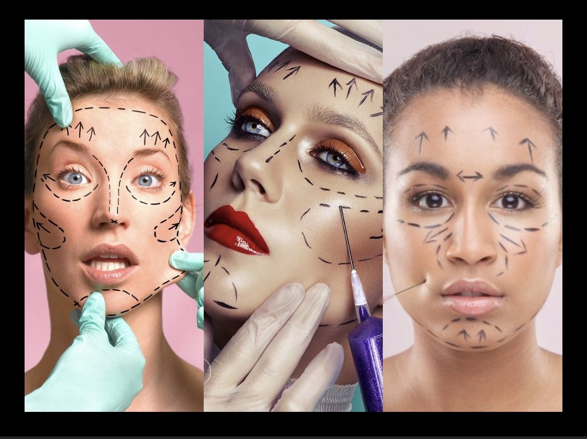 Cirugías Estéticas: Las transformaciones exageradas de las famosas ...