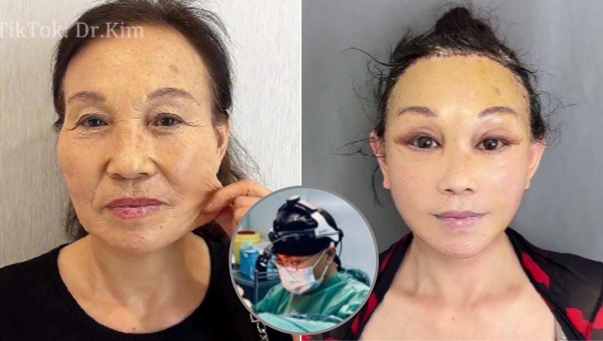 Dr. Kim: Las transformaciones más impactantes del cirujano plástico de ...